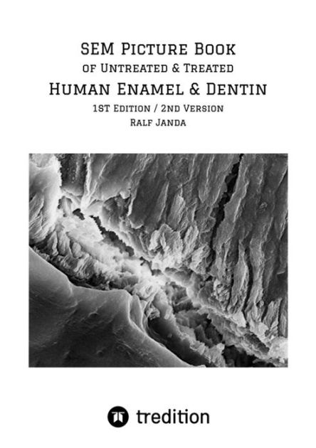 SEM Picture Book of Untreated & Treated Human Enamel & Dentin: High ...