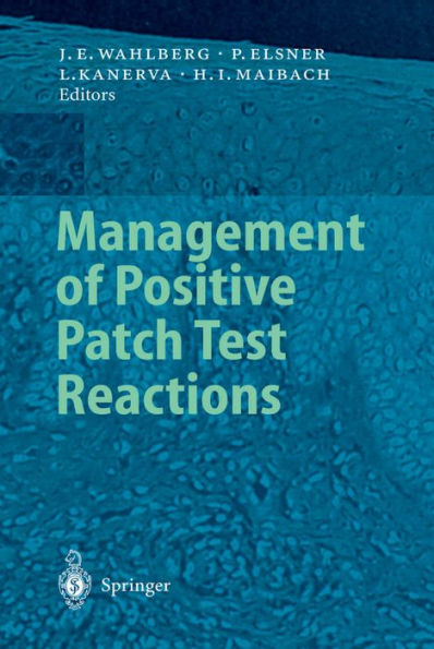 Management of Positive Patch Test Reactions by Jan E. Wahlberg | eBook ...
