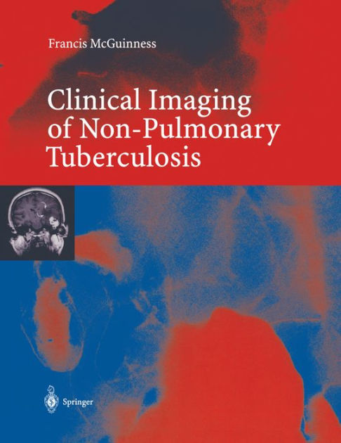 Clinical Imaging in Non-Pulmonary Tuberculosis by Francis E. McGuinness ...