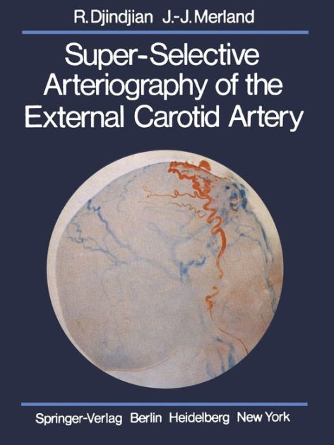 Super-Selective Arteriography of the External Carotid Artery by Rene ...