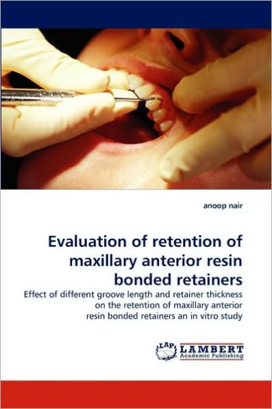 Evaluation of Retention of Maxillary Anterior Resin Bonded Retainers by ...