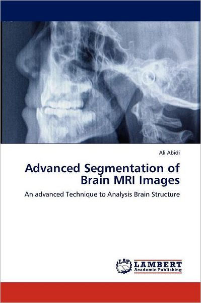 Advanced Segmentation of Brain MRI Images by Ali Abidi, Paperback ...