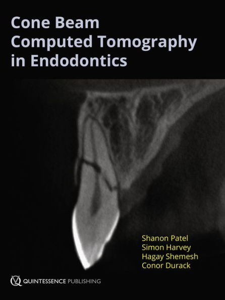 Cone Beam Computed Tomography in Endodontics by Shanon Patel, Simon ...