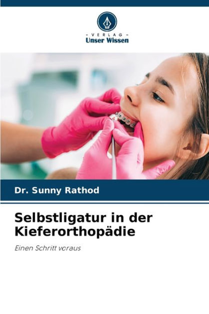 Selbstligatur in der Kieferorthopädie by Dr. Sunny Rathod, Paperback ...