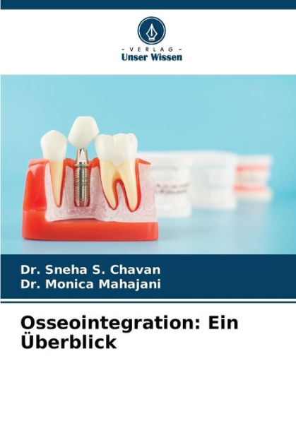 Osseointegration: Ein Überblick by Dr. Sneha S. Chavan, Dr. Monica ...