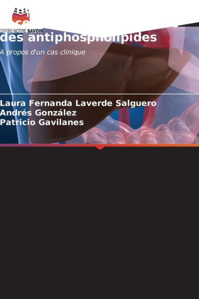 Syndrome de Budd Chiari secondaire Ã un syndrome des antiphospholipides ...
