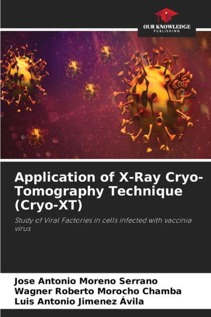 Application of X-Ray Cryo-Tomography Technique (Cryo-XT) by Jose ...