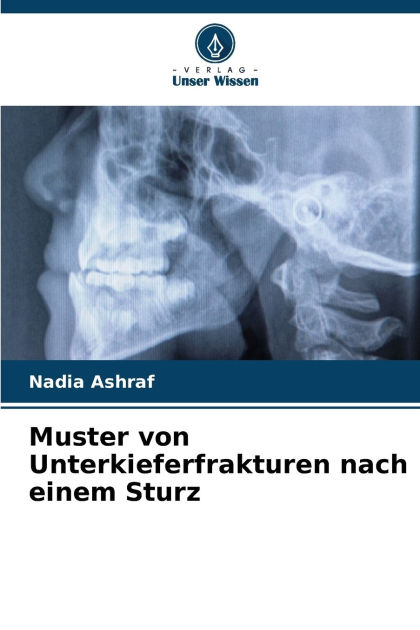 Muster von Unterkieferfrakturen nach einem Sturz by Nadia Ashraf ...