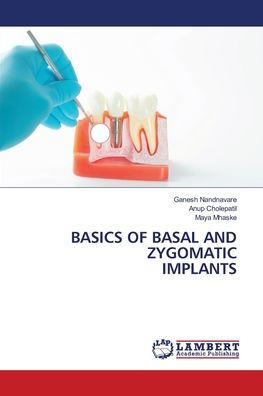 Basics of Basal and Zygomatic Implants by Ganesh Nandnavare, Anup ...
