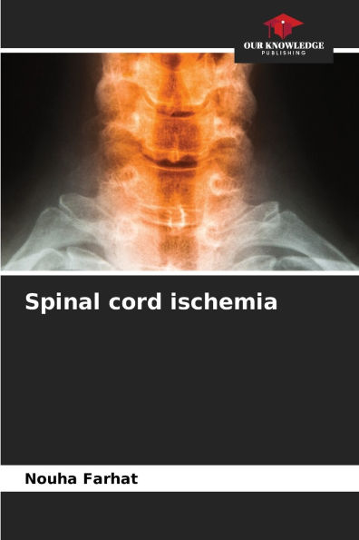 Spinal cord ischemia by Nouha Farhat, Paperback | Barnes & Noble®
