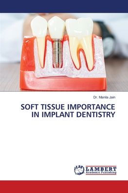 Soft Tissue Importance in Implant Dentistry by Manila Jain, Paperback ...