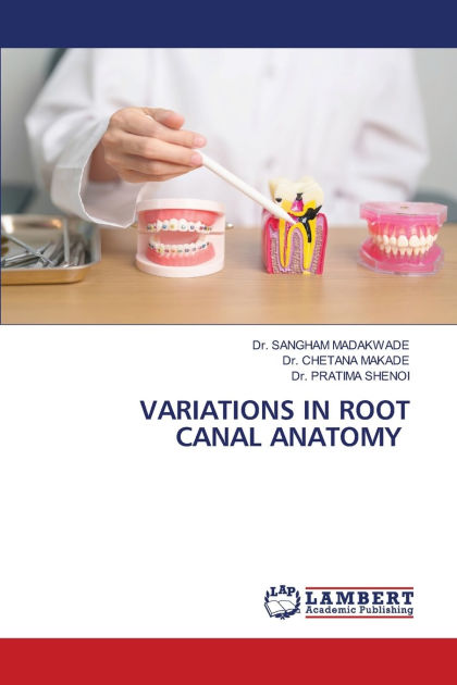 Variations in Root Canal Anatomy by Sangham Madakwade, Chetana Makade ...