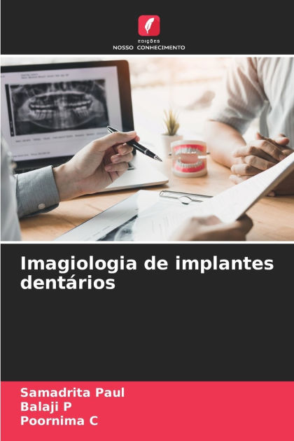Imagiologia de implantes dentï¿½rios by Samadrita Paul, Balaji P ...
