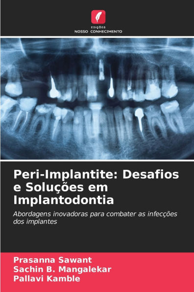 Peri-Implantite: Desafios e Solu��es em Implantodontia by Prasanna ... Peri-Implantite: Desafios e Solu��es em Implantodontia by Prasanna ...