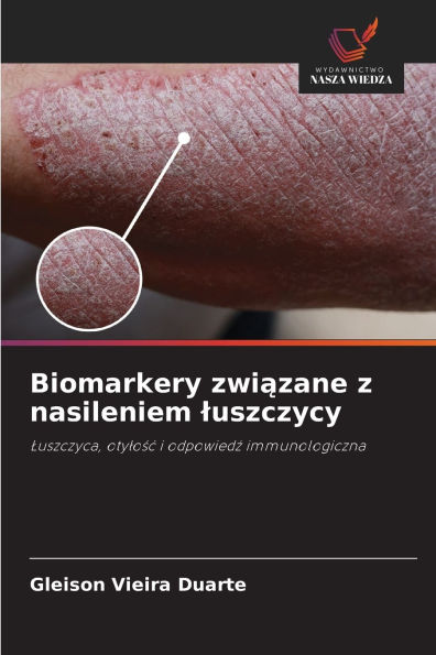Biomarkery związane z nasileniem luszczycy by Gleison Vieira Duarte ...