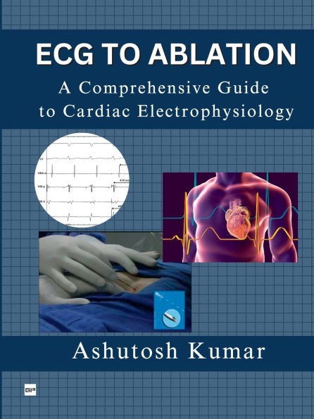 ECG to Ablation: A Comprehensive Guide to Cardiac Electrophysiology by ...