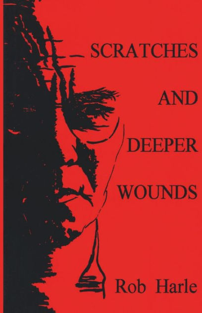 SCRATCHES AND DEEPER WOUNDS by Rob Harle, Paperback | Barnes & Noble®