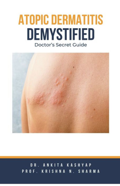 Atopic Dermatitis Demystified: Doctor's Secret Guide by Dr. Ankita ...