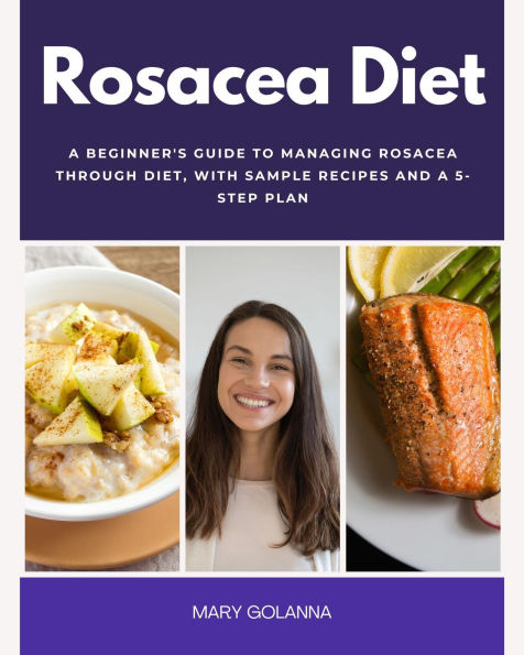 Rosacea Diet: A Beginner's Guide to Managing Rosacea Through Diet, With ...